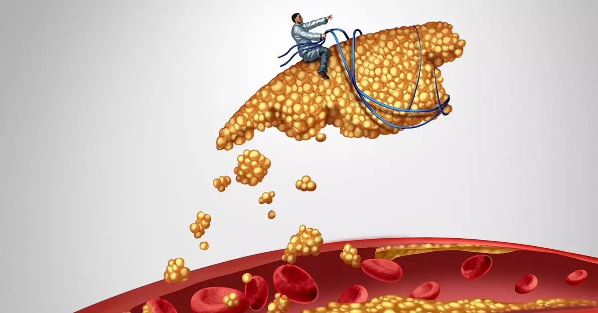 7 Abubuwan da ba tsammani game da cholesterol